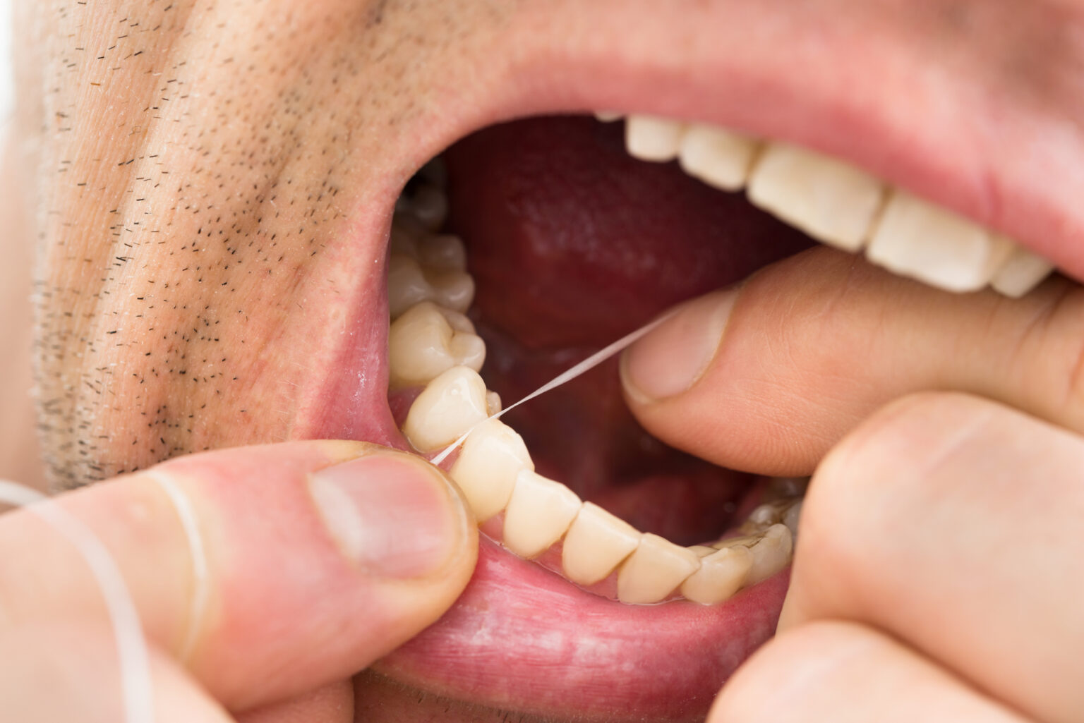 How to Floss Your Teeth (and What Happens if You Don’t)